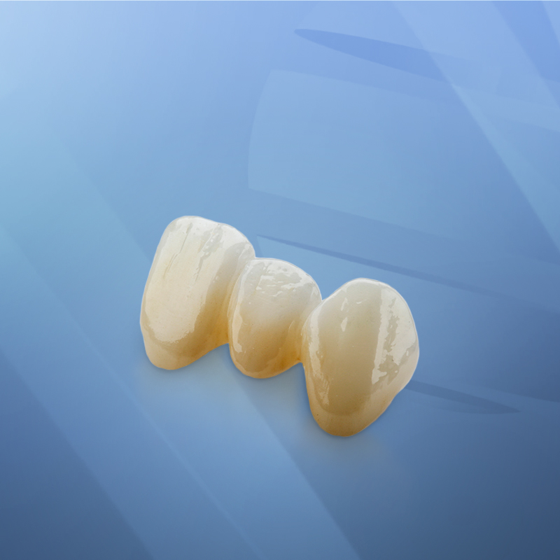 Lithium Disilicate | Elegant Lab